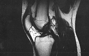 Radiologie, MRT und Nuklearmedizinische Diagnostik in Heidelberg